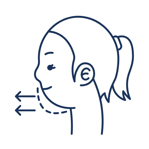 Chin Implant in Turkey | Fibemed Healthcare